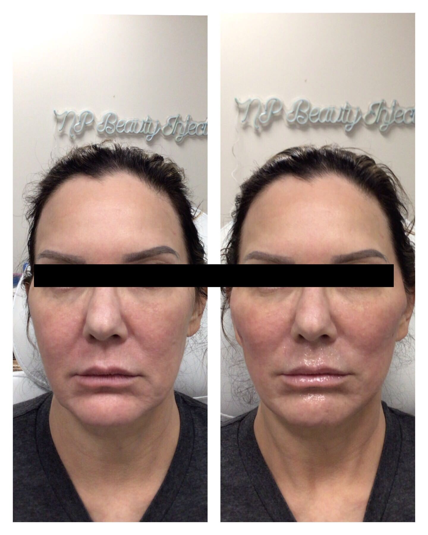 B&A 21: Lunch Time Lift | Saintly Skin